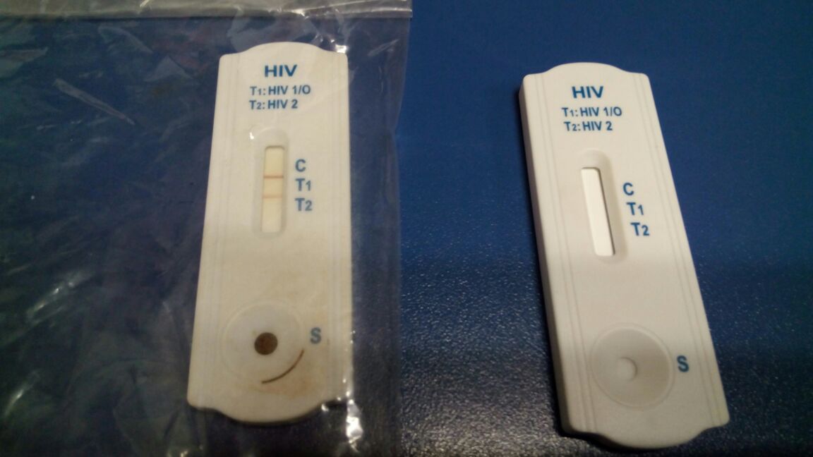 Consultorio de Temuco está realizando test rápido de VIH: Procedimiento ...