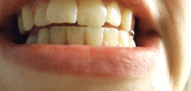 6 malos hábitos que pueden arruinar tus dientes | Sociedad | BioBioChile