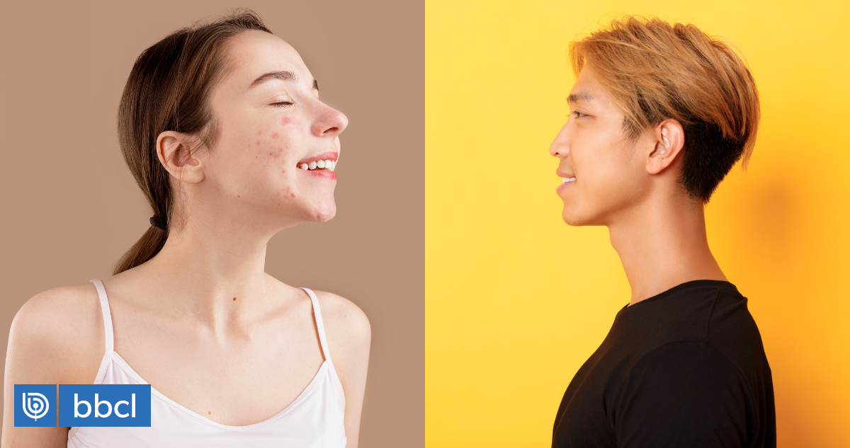 ¿Tienes la cara alargada y la boca pequeña? La forma de la cara podría deberse a la forma de ...