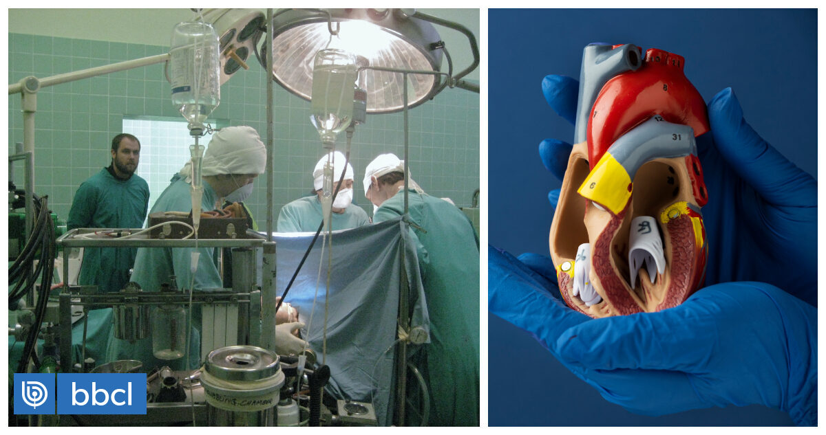 Logran por primera vez trasplante de corazón que pasó 20 minutos "muerto"