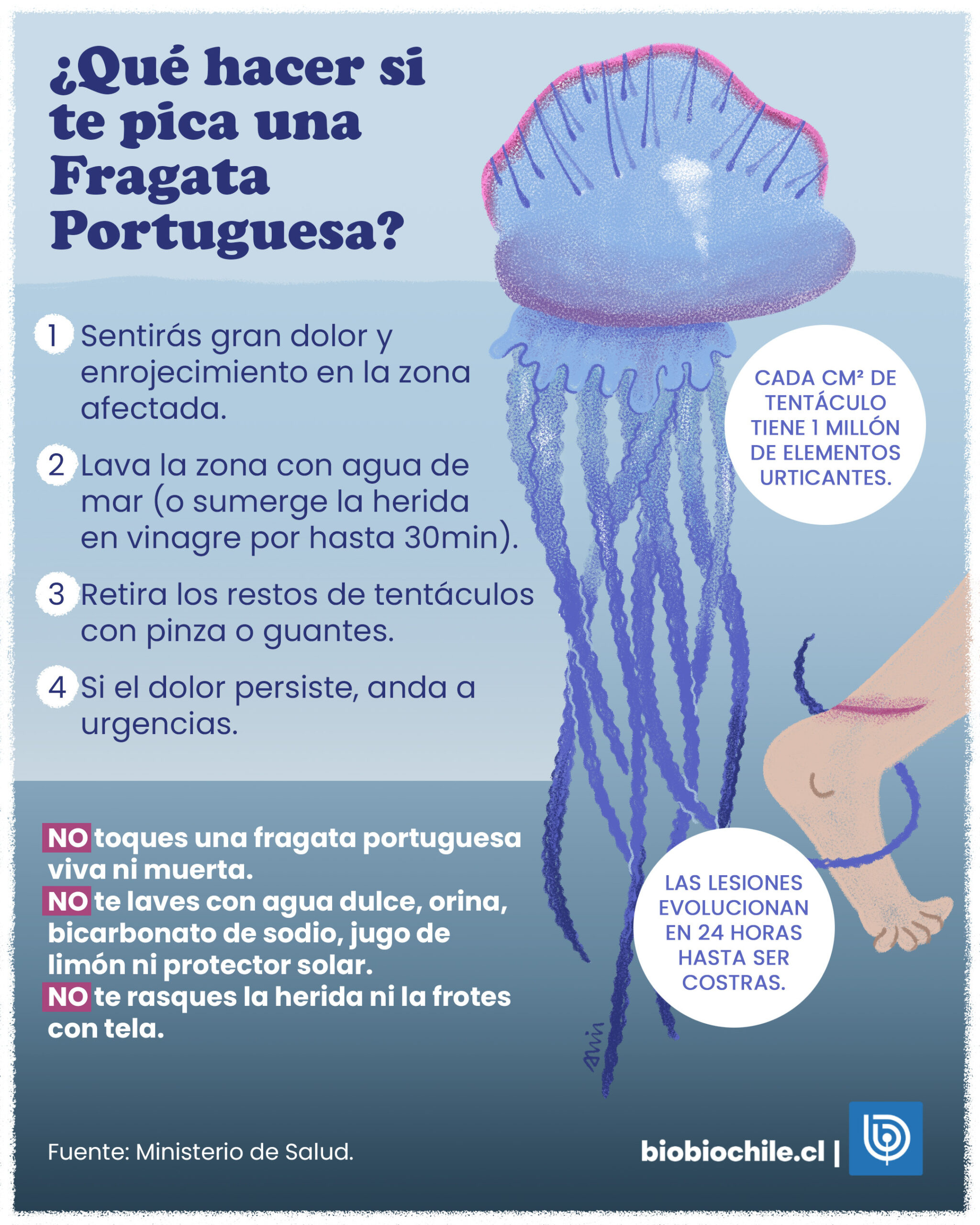 Puede ser letal: qué hacer si te pica una fragata portuguesa y cómo ...