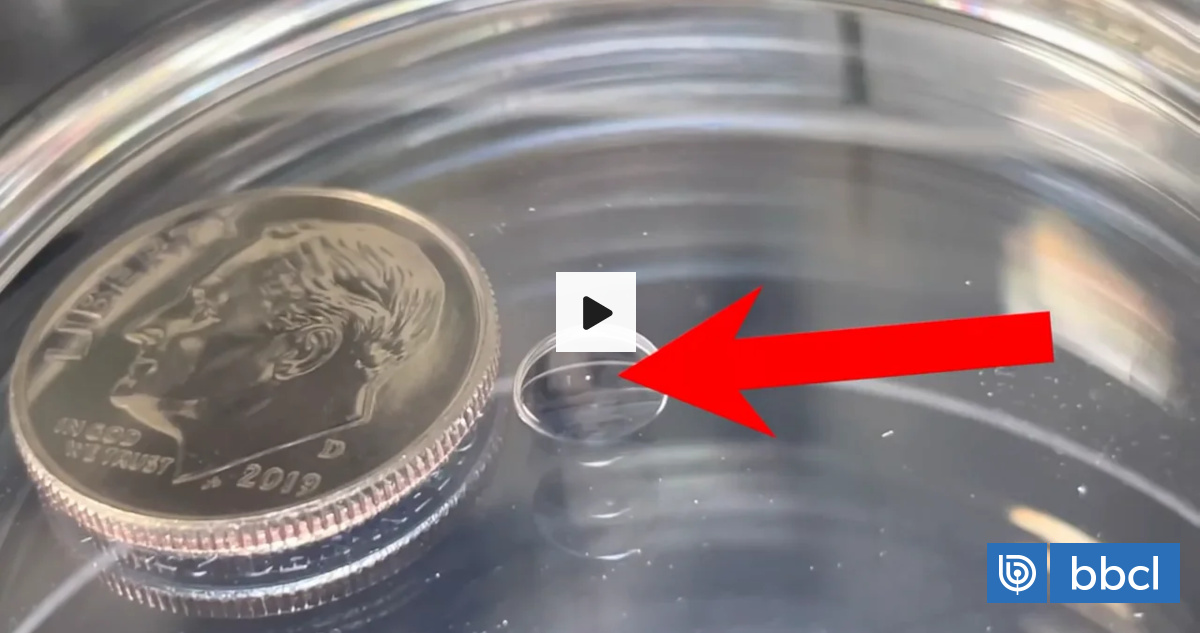 IMG! La única célula del cuerpo humano que se puede observar a simple ...