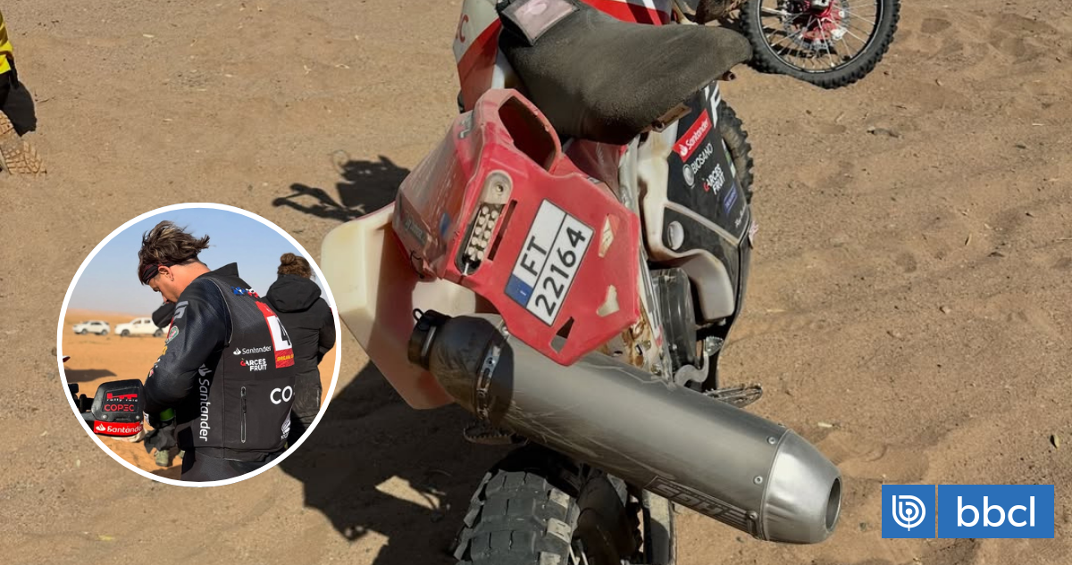 "Gracias a Dios estoy vivo": Ruy Barbosa muestra cómo quedó tras grave ...